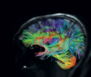 Human Connectome Project, the search for information and data about the ...